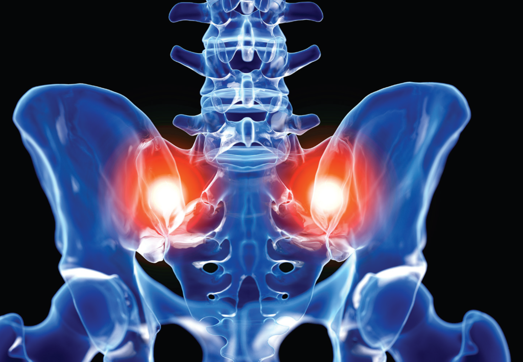 Pictures Psoriatic Arthritis Understanding Symptoms - cstims